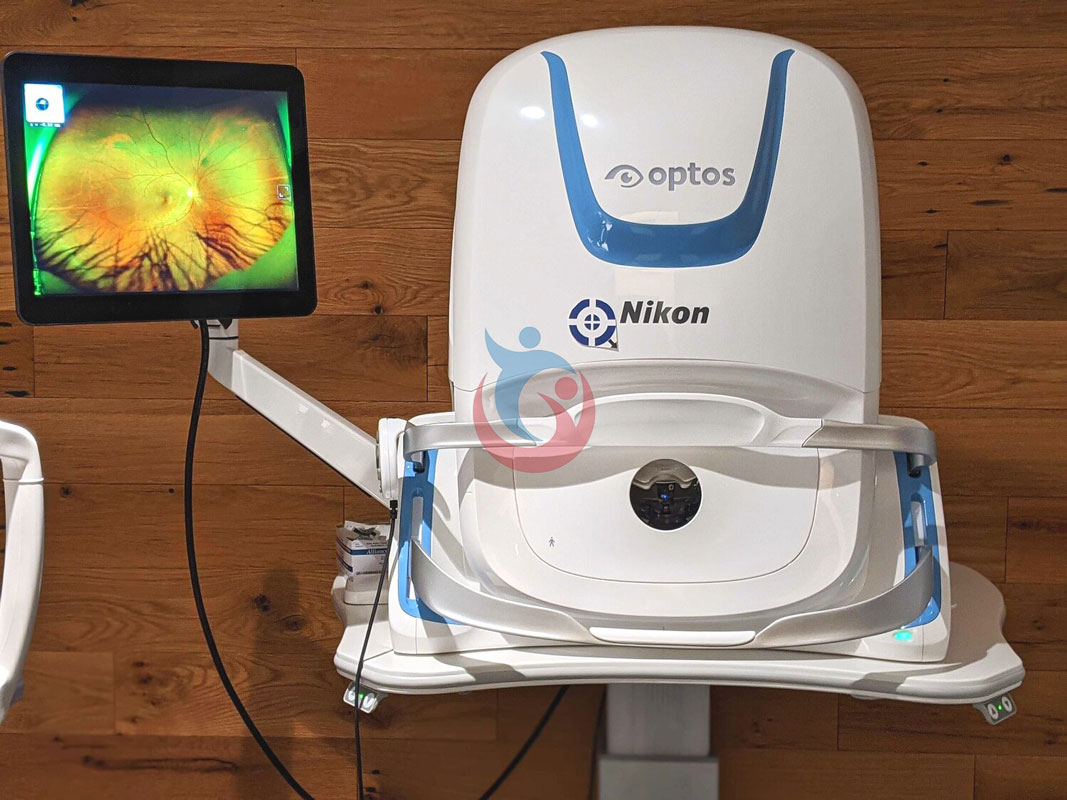 Optos Monaco Ultra WideField Retinal - Aesthetics Medical Laser